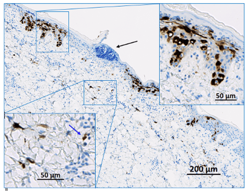 Use Cases and Benefits of Immunohistochemistry, Immunofluorescence, and ...