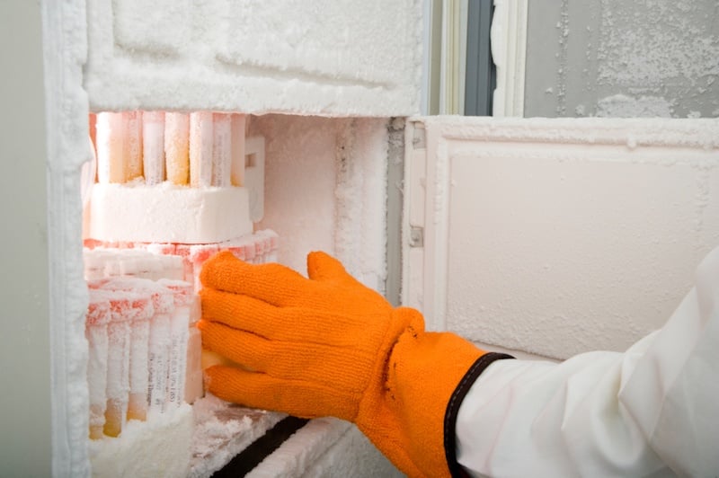 Specimen Storage How To Store Your Ultralow Frozen Materials Properly