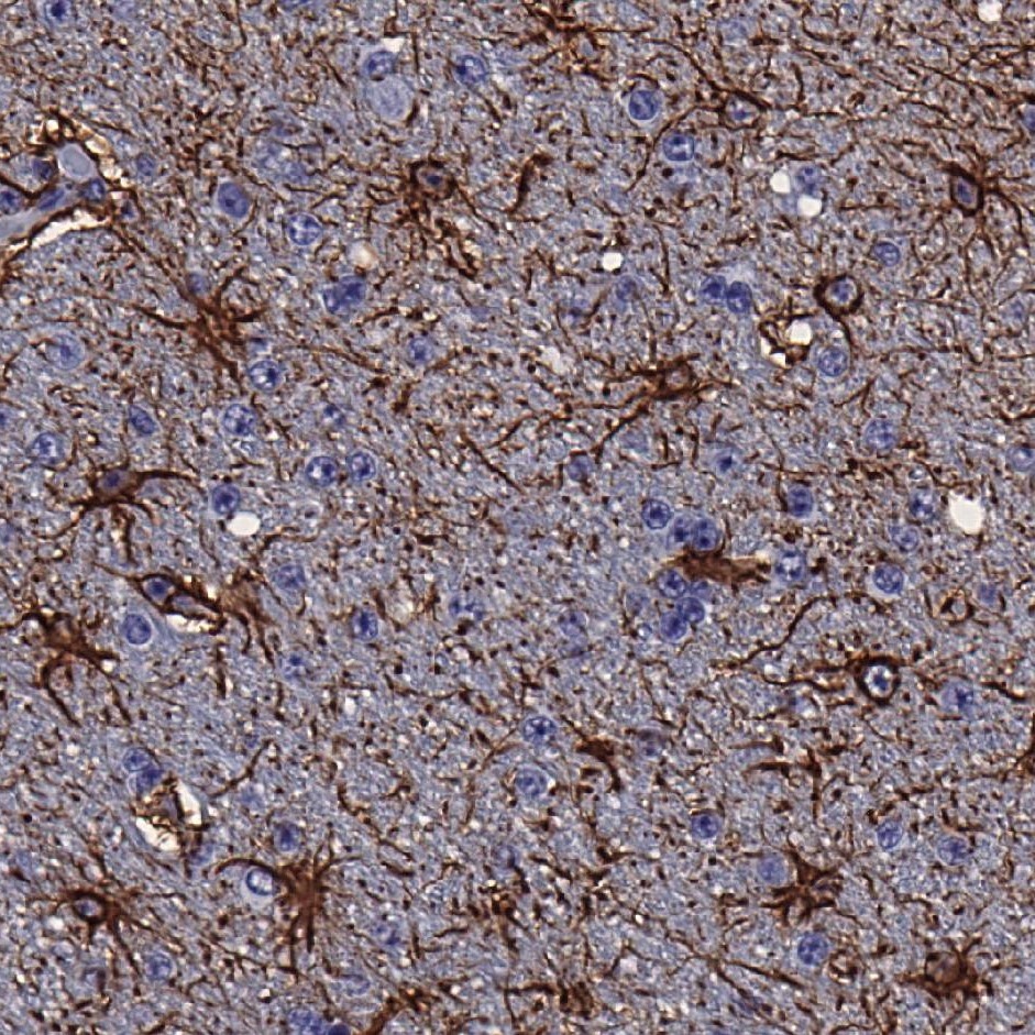 IHC or IF: Which is Best for My Study?