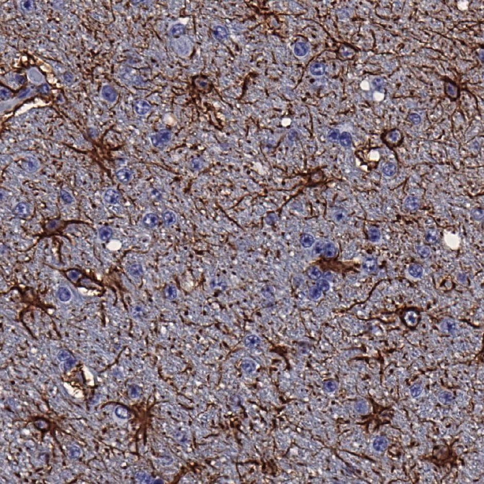 IHC or IF: Which is Best for My Study?