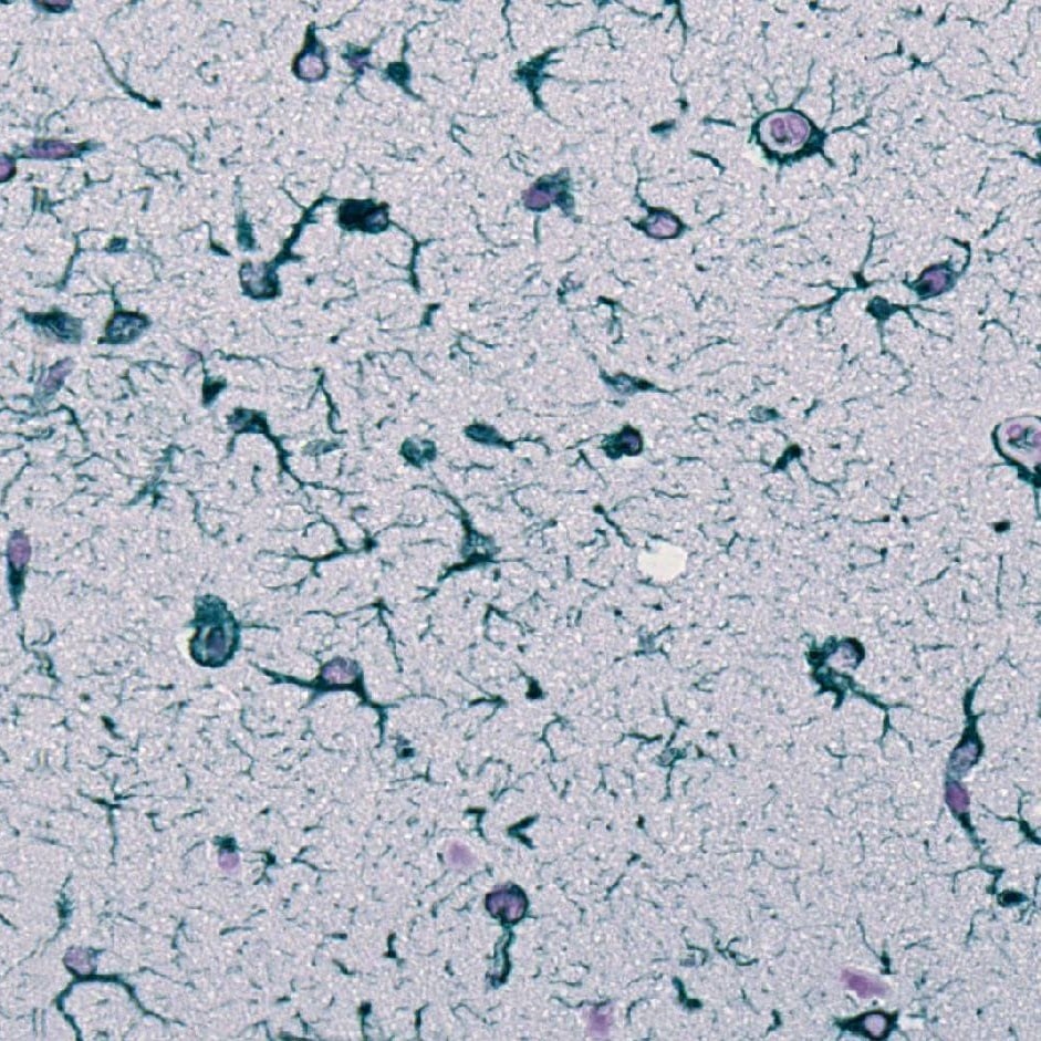 IHC or IF: Which is Best for My Study?