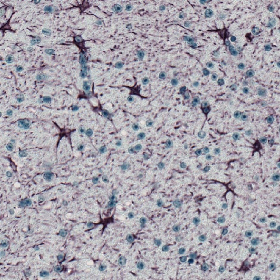 IHC or IF: Which is Best for My Study?