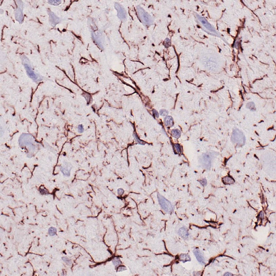 IHC or IF: Which is Best for My Study?