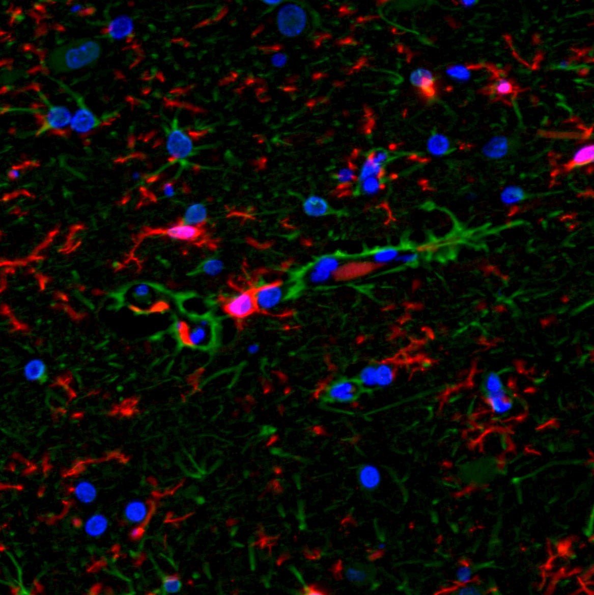 IHC or IF: Which is Best for My Study?