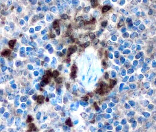 Immunohistochemistry and Immunofluorescence Explained